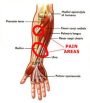 Forearm Tendonitis Injury: All you need to know | Playo